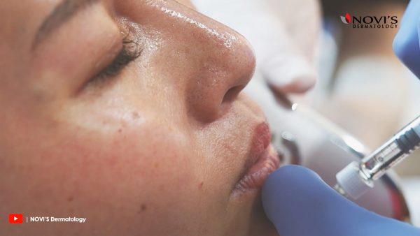 Tanda-Tanda Autisme Dewasa dan Penanganan yang Tepat – NOVIS ...