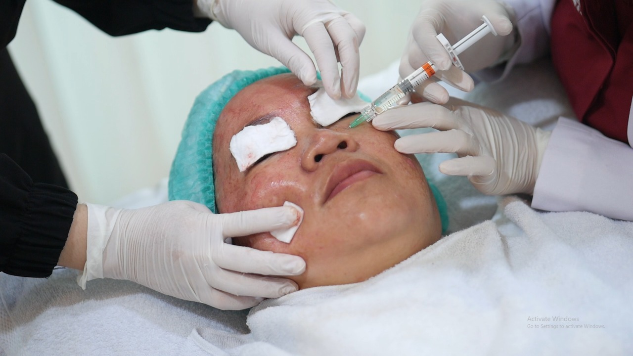 Memperbaiki Tektur Kulit Bopeng yang Disebabkan Oleh Jerawat – NOVIS ...